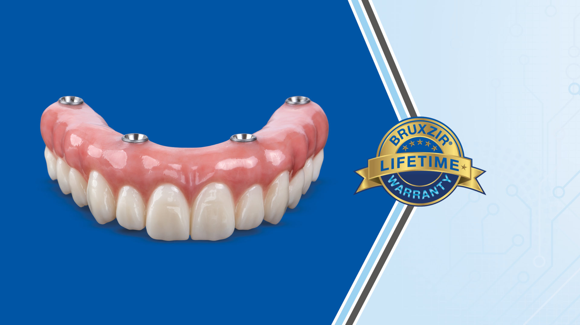BruxZir® Implant Prosthesis - Riverside Dental Ceramics